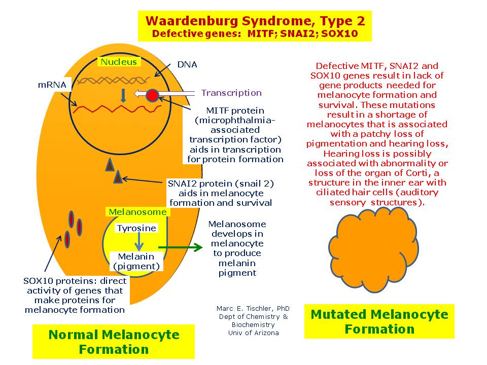 Waardenburg Syndrome Type 2 Hereditary Ocular Diseases